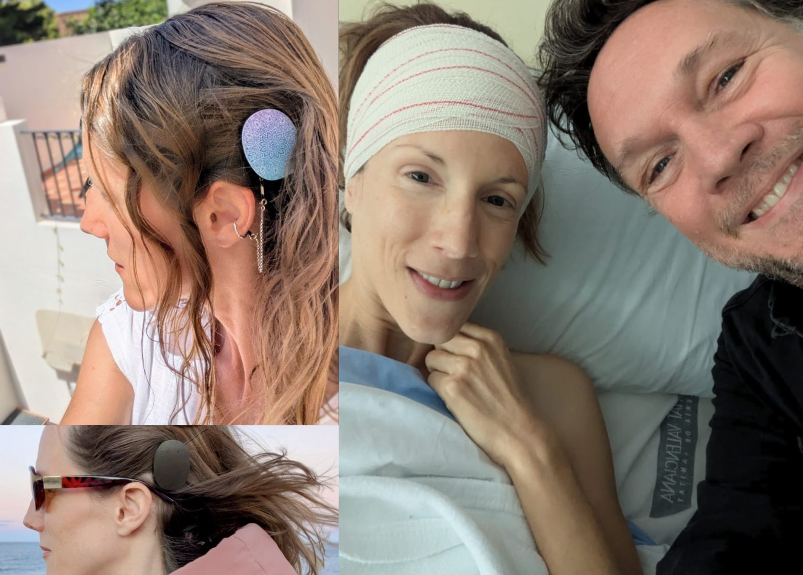 My Cochlear Implant Story: Part 18 – One Year Post-Implantation – My ...
